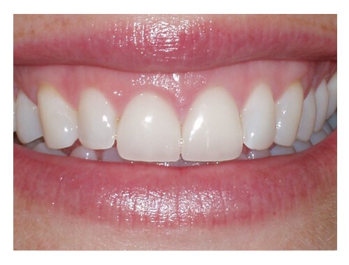 brick - Distinctive Dentistry Blog